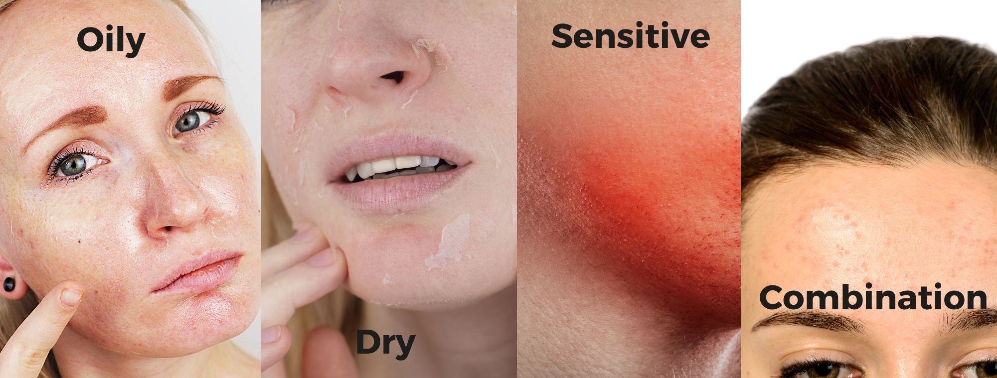 What Skin Type Do I Have? Discovering The Different Skin Types - London ...